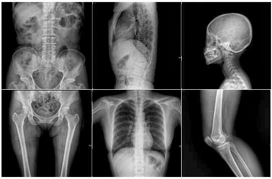 Radiologi, Computer dan Teknologi: Pengertian Radiologi