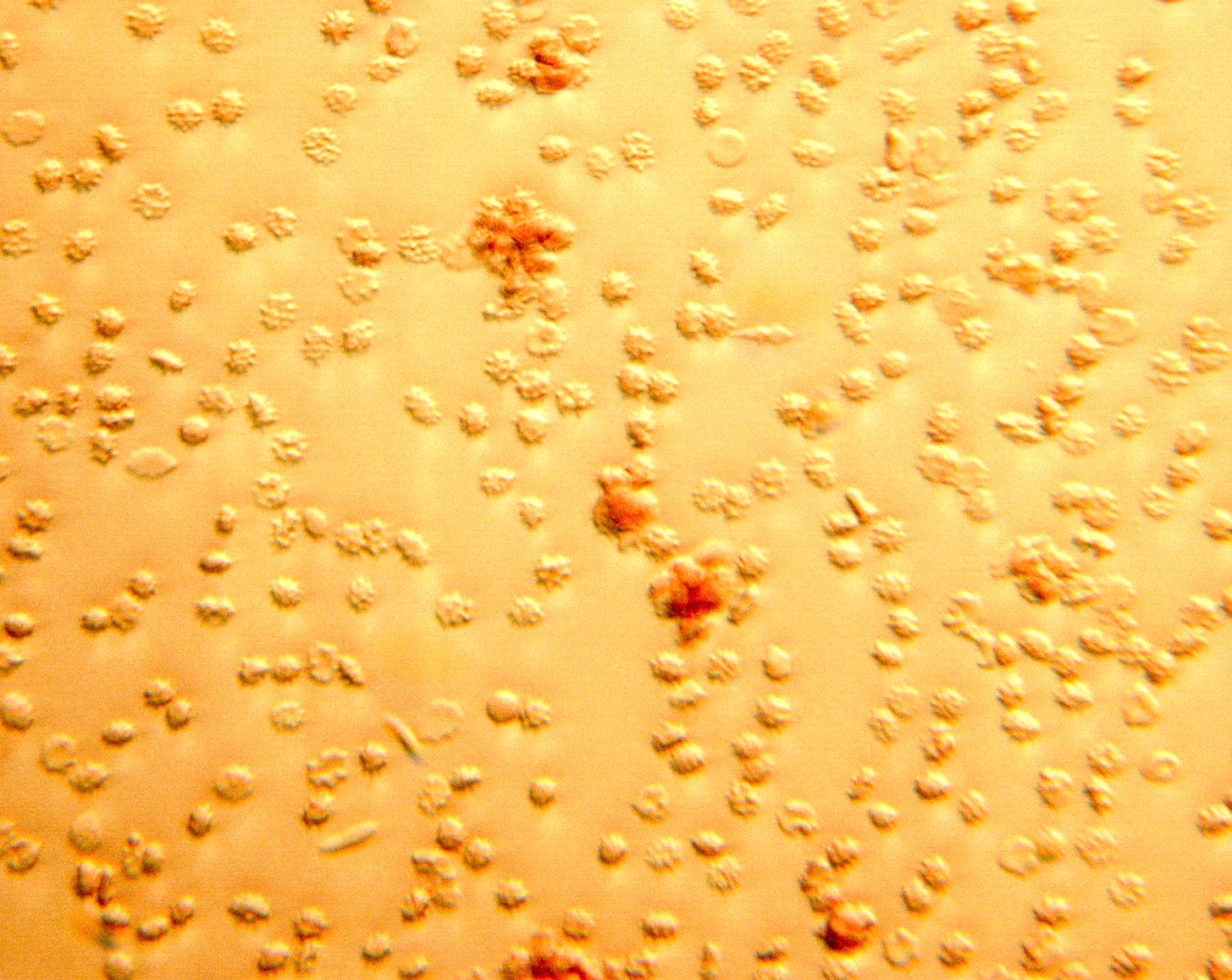 Lecture Notes in Medical Technology: Lecture #9: HEMOLYTIC DISEASE OF ...