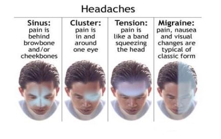 Cluster Headache ~ ALL ABOUT YOUR HEALTH
