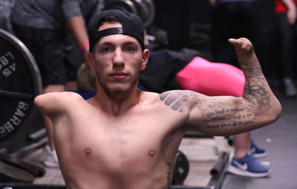Guy Born Missing Both Legs And One Arm Crushes It In The Gym ~ HealthBet