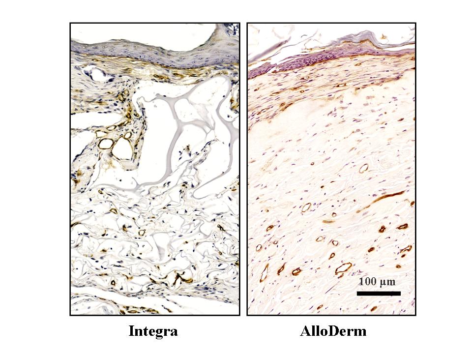 My unpublished biomedical research: Wound Healing and ...