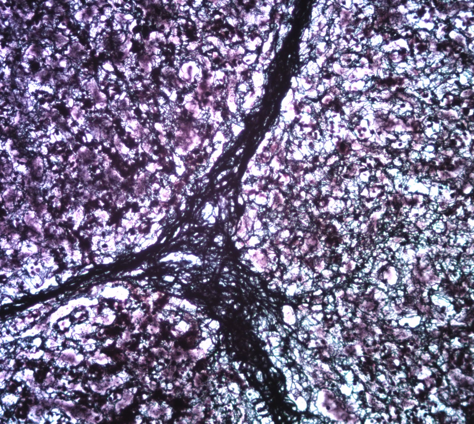 Histologia dos Tecidos: Tecido conjuntivo reticular