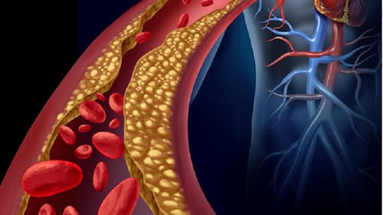 Baixe Rapidamente Colesterol e Triglicerídeos "alto" - Blog Universo ...