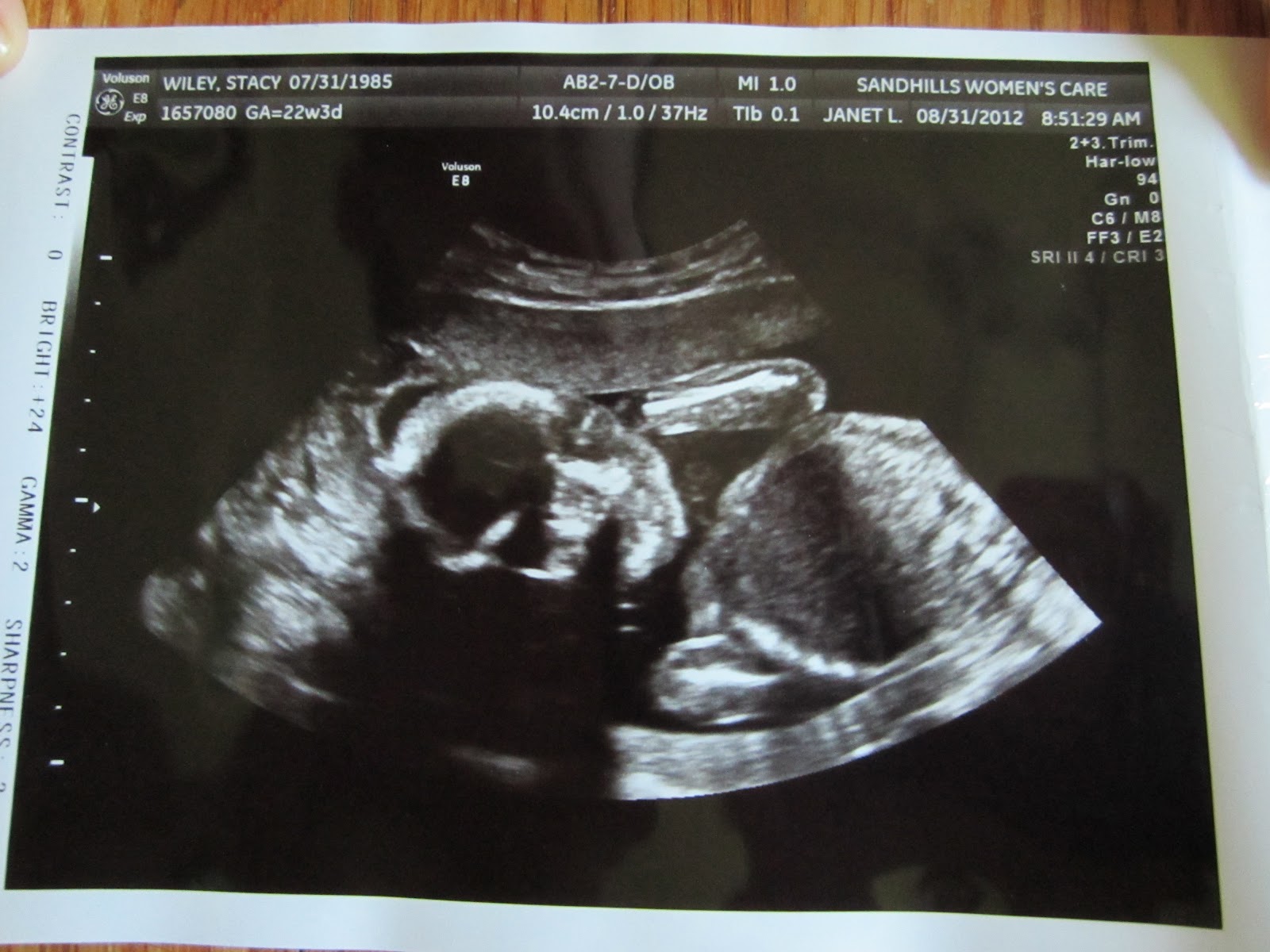 The Wiley Family: 21 Week Ultrasound