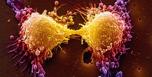 Como prevenir o cancro