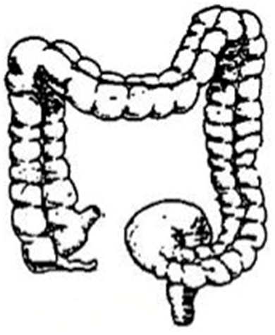 Health And Wellbeing: Healthy Colon Vs Unhealthy Colon