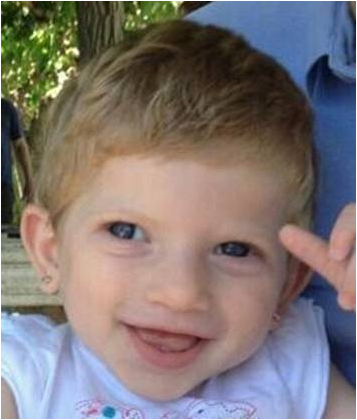 Sindrome de Angelman