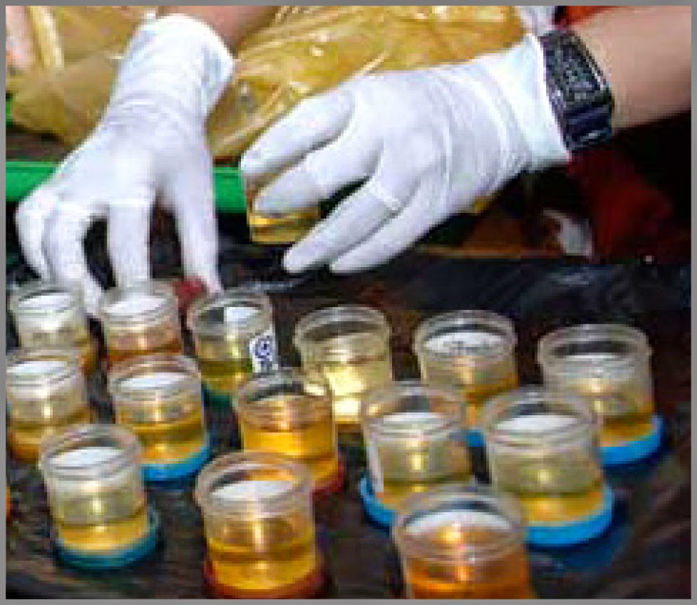 Apa Saja yang Bisa Diketahui Melalui Tes Urine? | Hidup Sehat