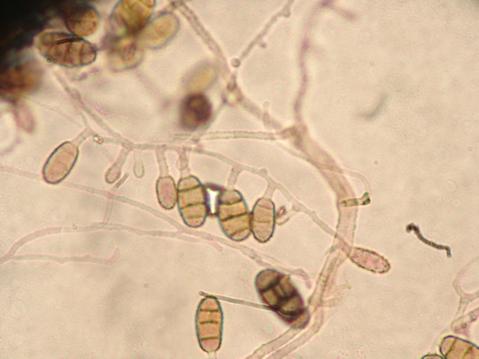 Sustainable Mycology: Pithomyces spp.