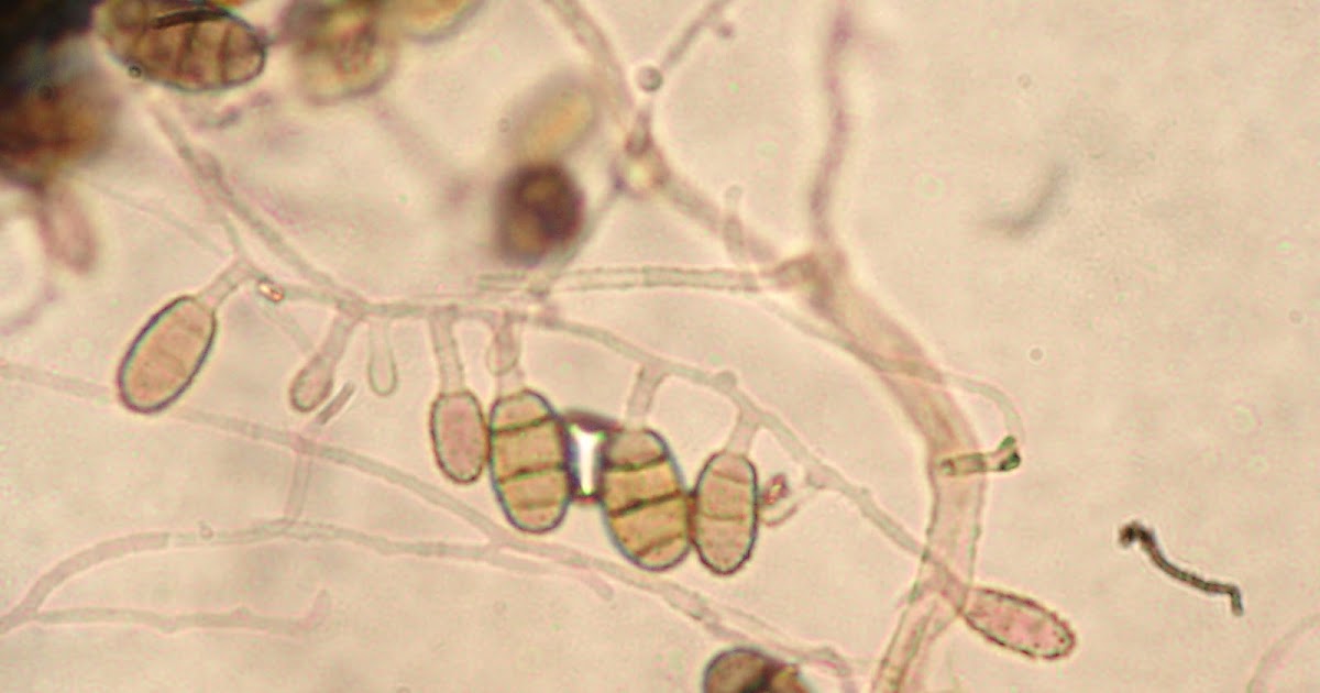 Sustainable Mycology: Pithomyces spp.