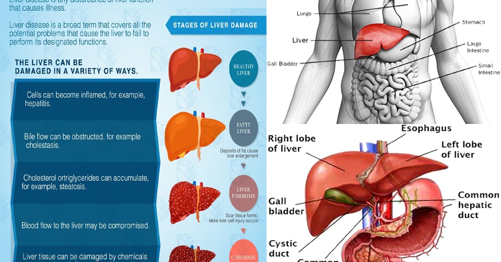 Obat Liver di Apotik: Lamanya proses penyembuhan yang harus di lalui ...