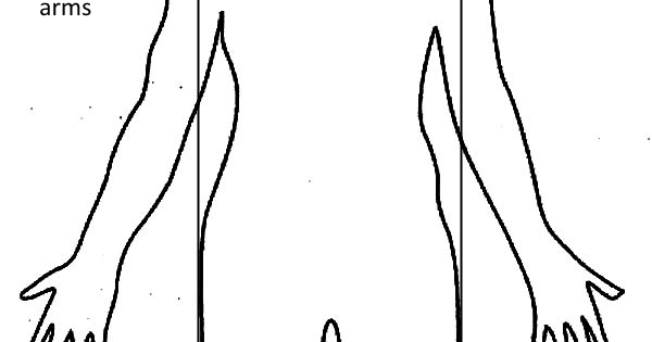 Dreams and Fevers: My 5e Wound Table and Encumbrance