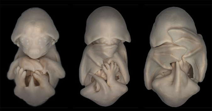 Strawberry Fields Whatever: Holla at a Baby Bat Embryo
