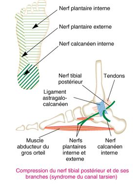 Un médecin du sport vous informe: Microtraumatologie de l'Astragale