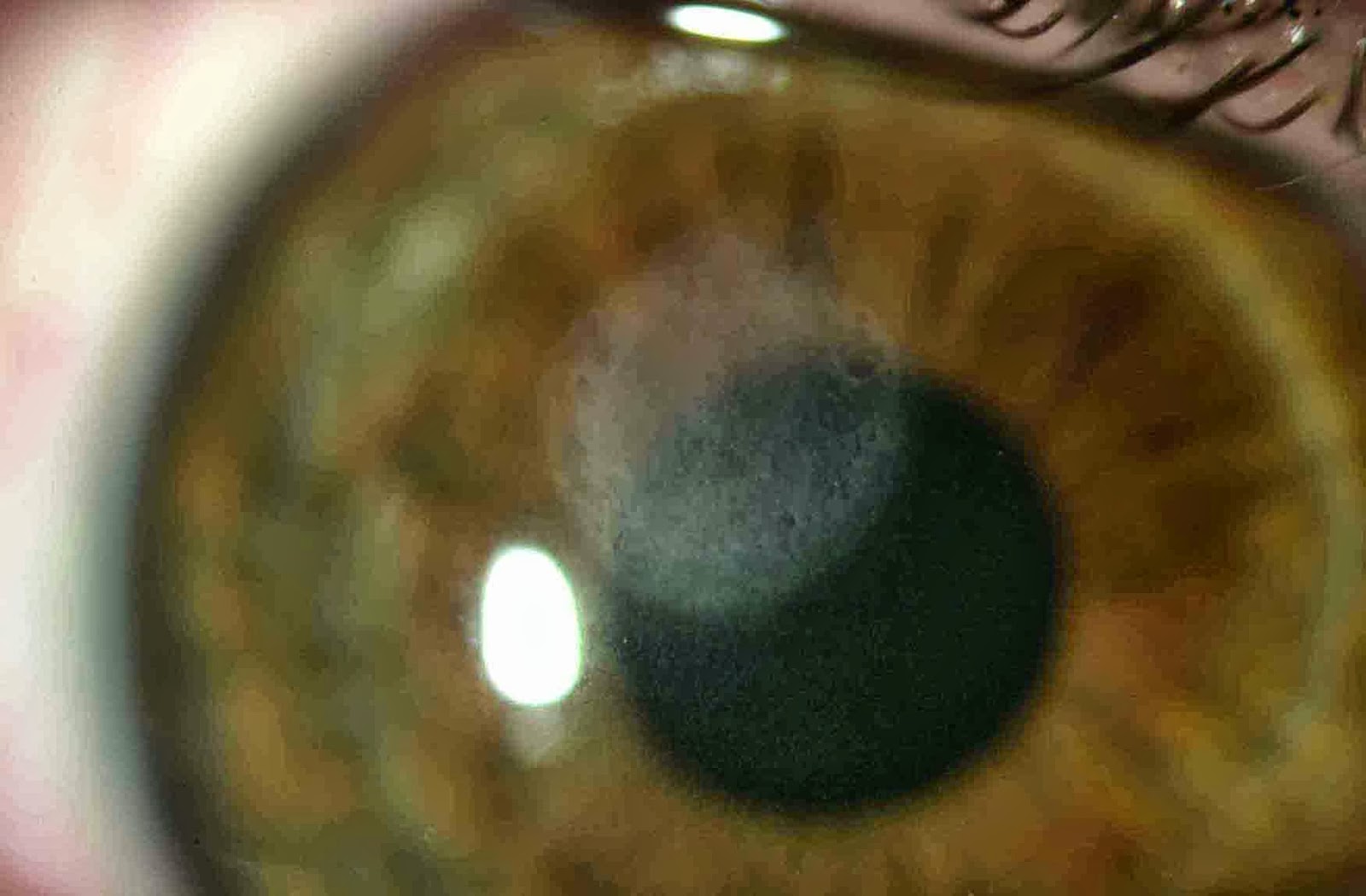 Great Huffington Post Article Educates Proper Contact Lens Care ...