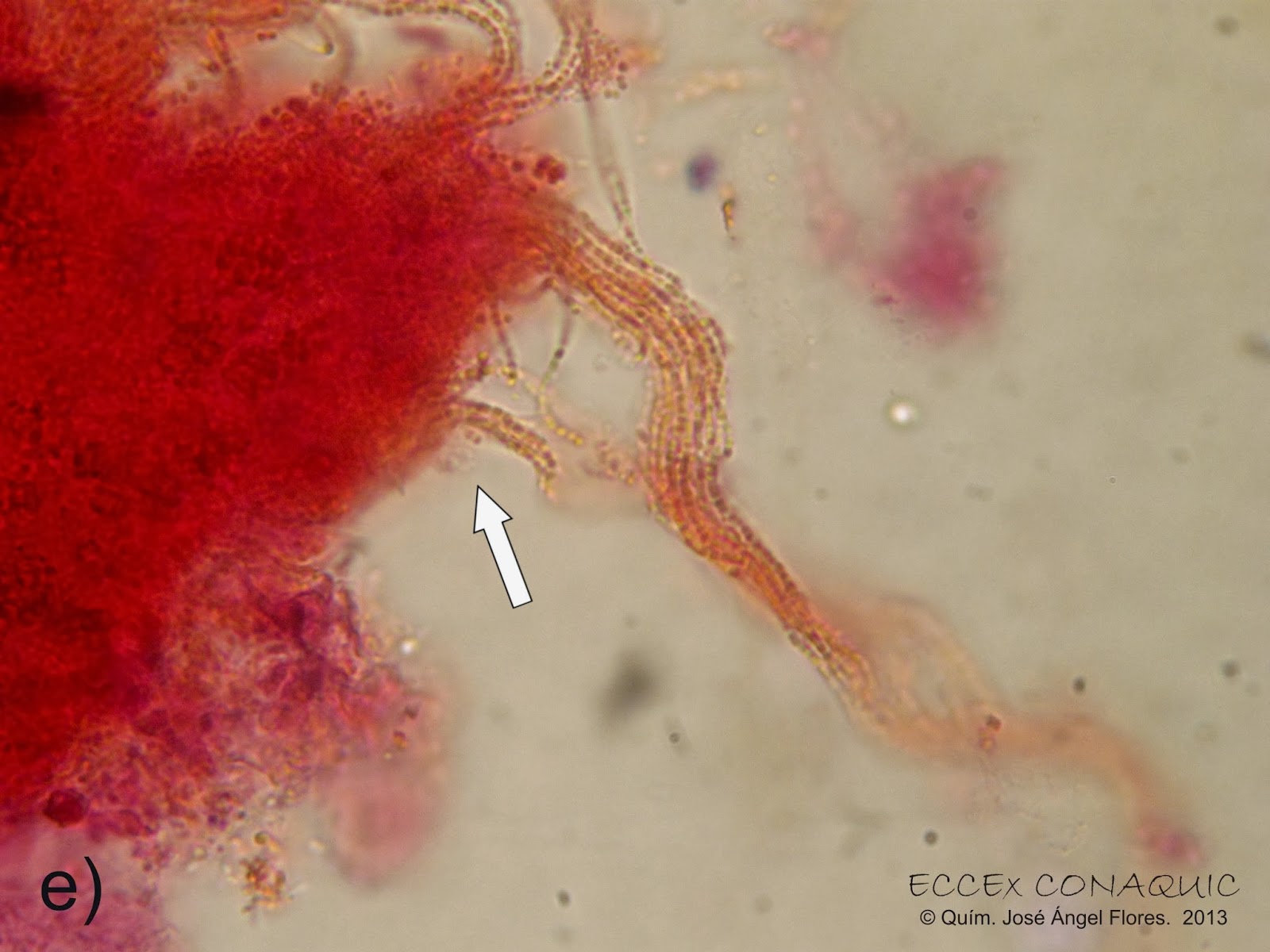 Caso UR-noviembre-13 (Enfoque: uroepitelio)
