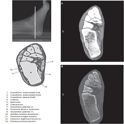 Ankle and Foot - CT Imaging Technique - RadTechOnDuty