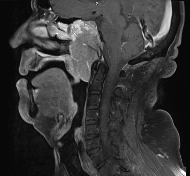 Imagistică RM de înaltă calitate la Centrul Medical SANCONFIND ...