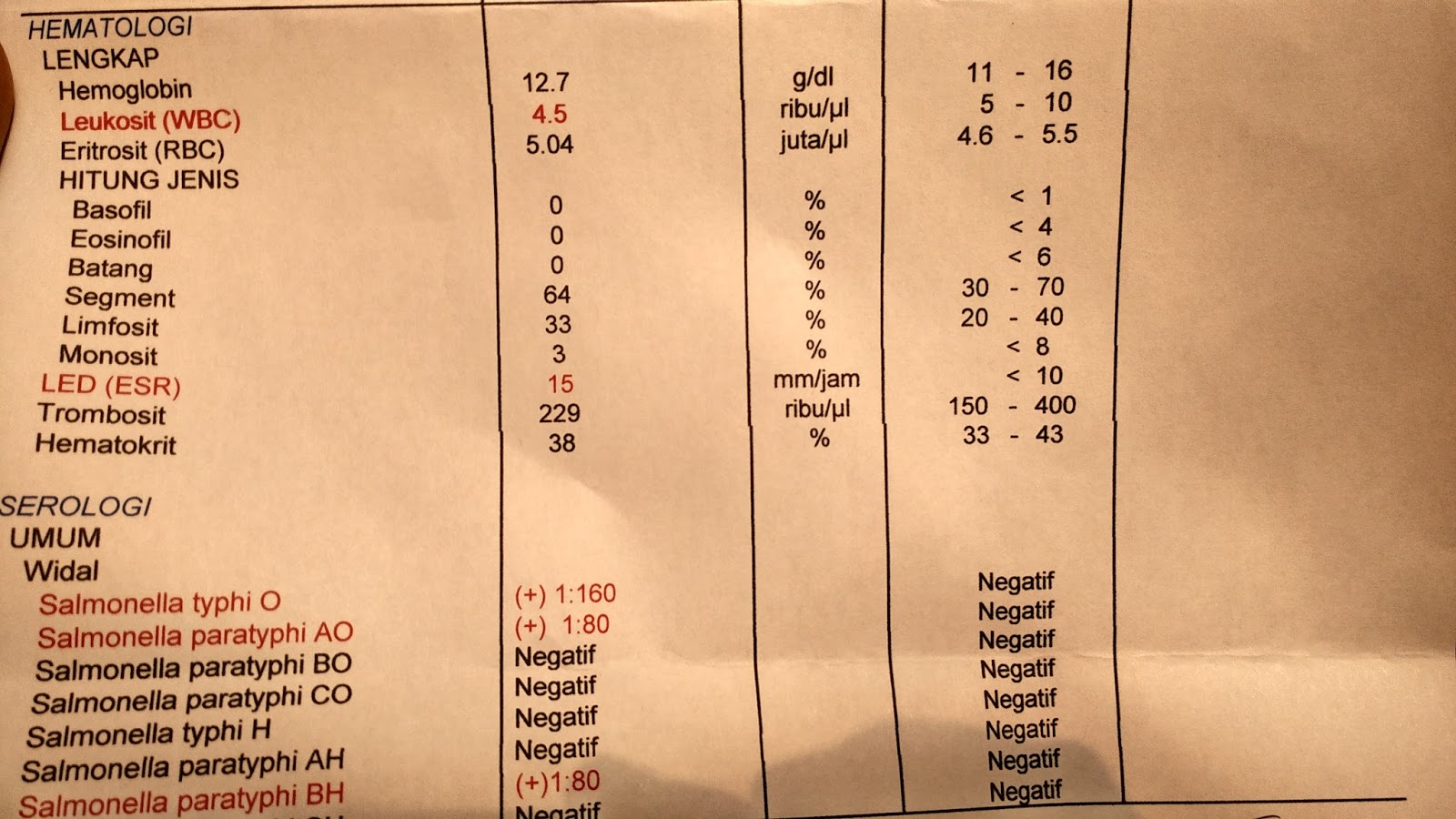 Demam Naik Turun, Waspada Terkena Typus!