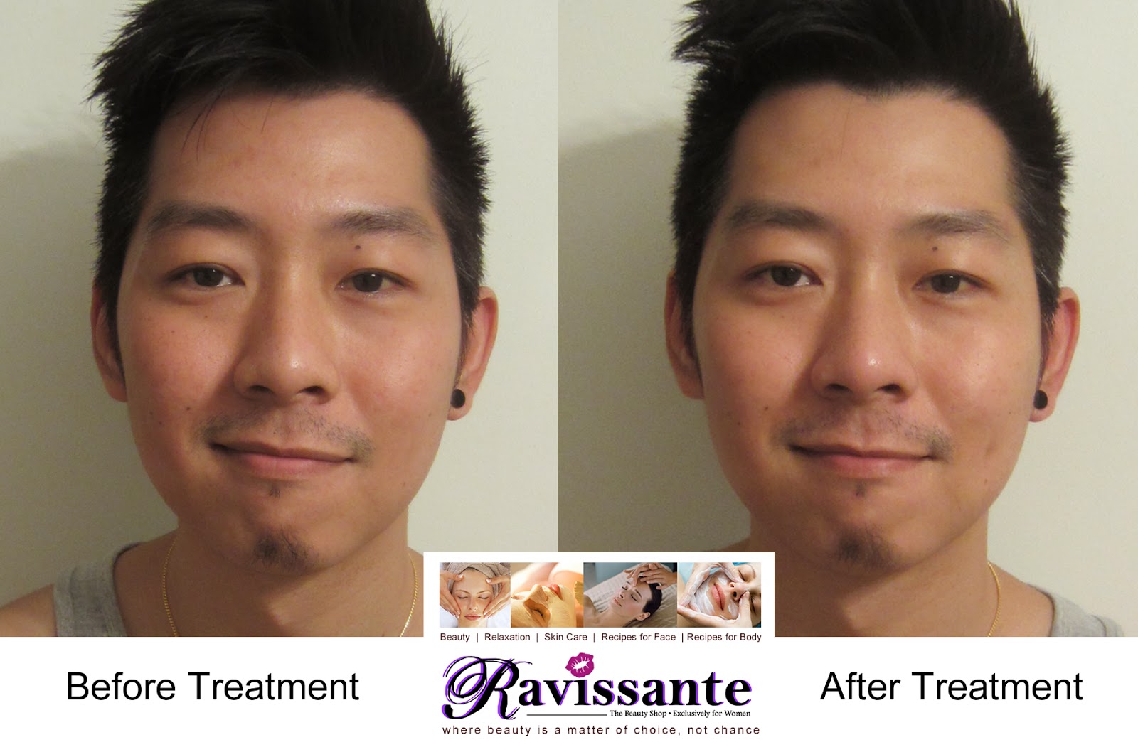 Anti-Aging for Men - A Ravissante Men Project #4