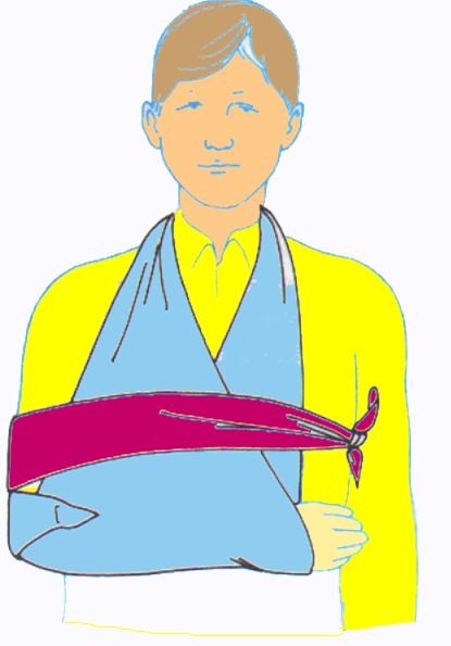 kUTEZEVO-pp: rana na roki