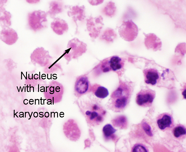Creepy Dreadful Wonderful Parasites: Answer to Case 229