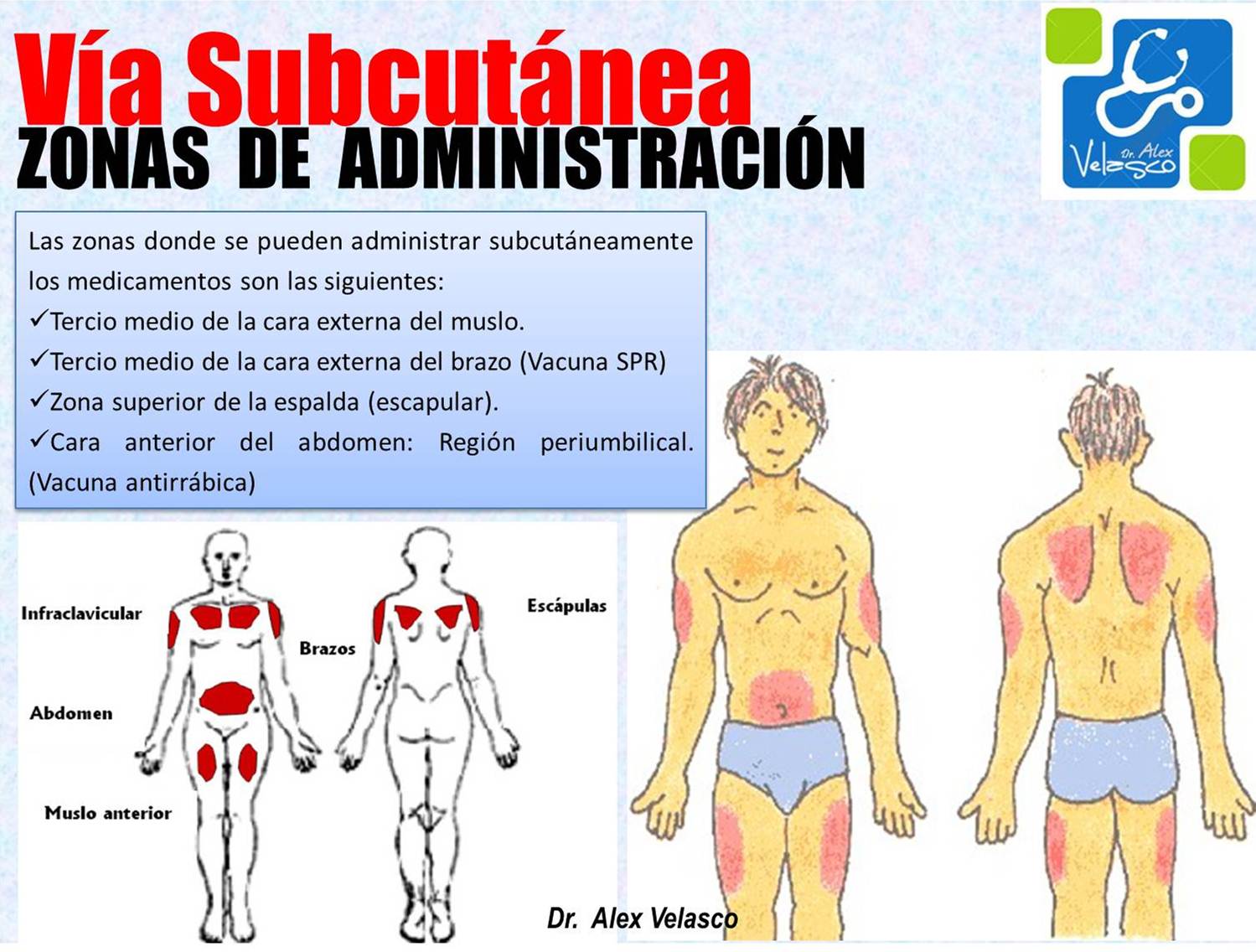 INYECTABLES ~ Dr. Alex Velasco