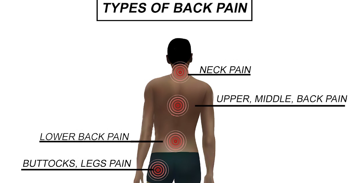 Back Pain Center: Upper, Mid & Lower Back