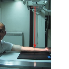 Radiología Silva2: Antebrazo AP