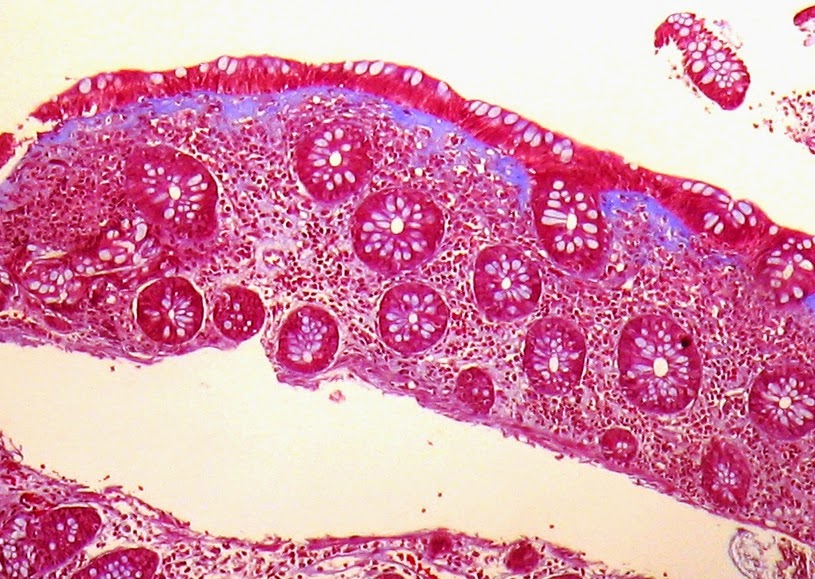 GASTROINTESTINAL AND LIVER HISTOLOGY PATHOLOGY ATLAS: COLON ...