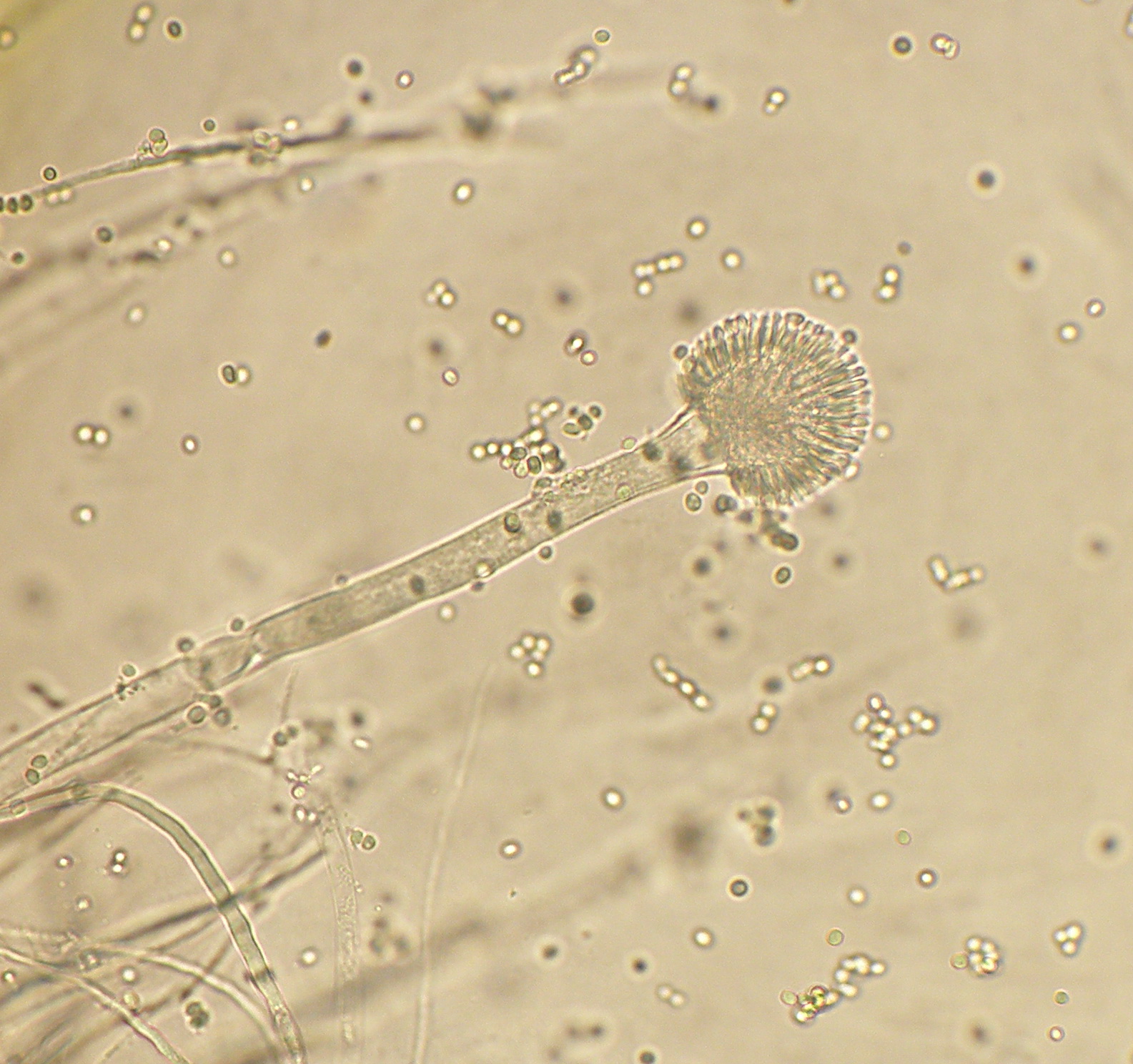 ATLAS MICOLOGIA: ASPERGILLUS FLAVUS