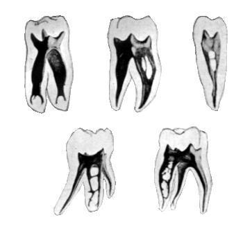 Root canal anatomy - Vertucci - Bauer Smiles