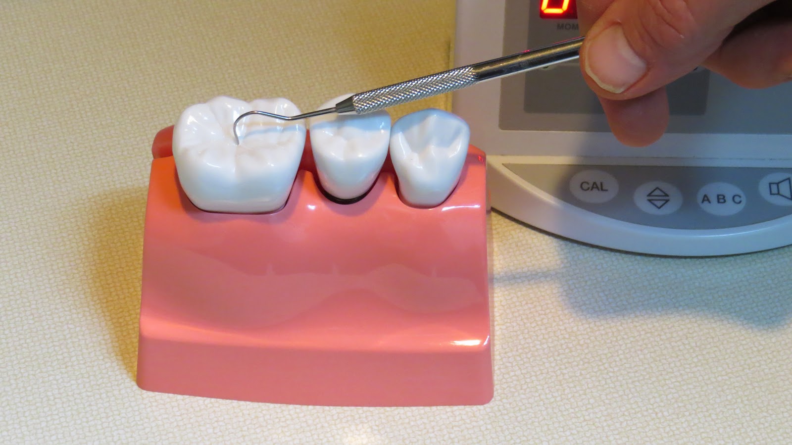 Davis Dental Diary: Kavo DIAGNOdent cavity detector