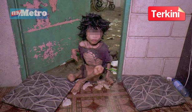 VIDEO : Remaja OKU 15 Tahun Dikurung Hingga Kurus Kering - Ohsem meh!