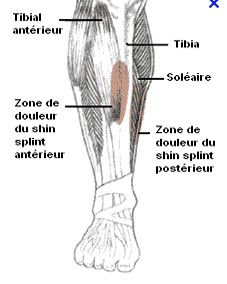 Un médecin du sport vous informe: Syndrome des loges musculaires de jambe