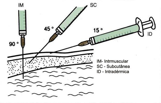 Turma T20 Técnico em enfermagem : Via Intradérmica, Via Intramuscular e ...