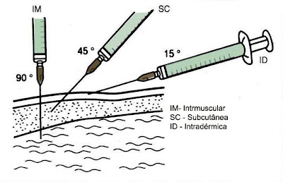Turma T20 Técnico em enfermagem : Via Intradérmica, Via Intramuscular e ...
