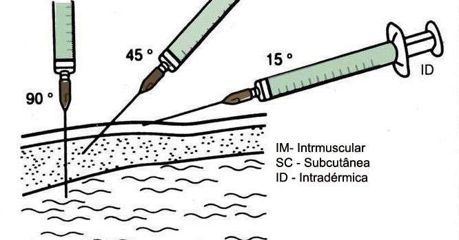 Turma T20 Técnico em enfermagem : Via Intradérmica, Via Intramuscular e ...