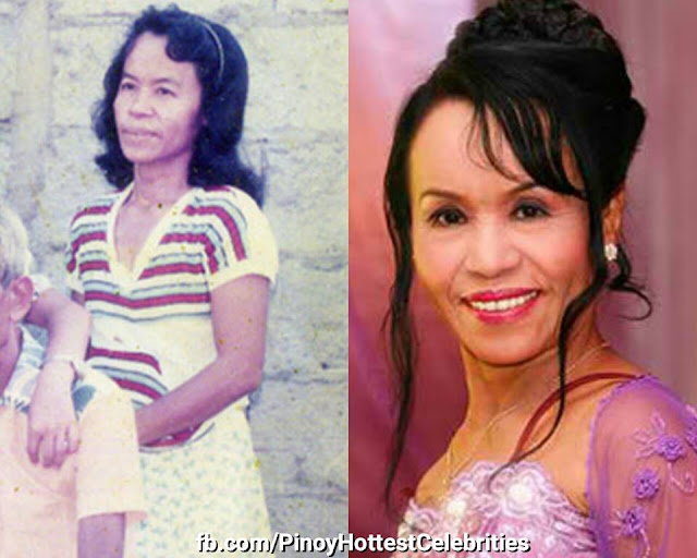21 Before And After Photos Of Filipino Celebrities