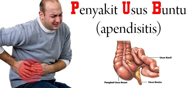 9 Fakta Seputar Usus Buntu ini Pasti Tidak Pernah Kamu Ketahui ...