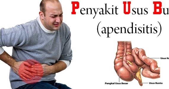 9 Fakta Seputar Usus Buntu ini Pasti Tidak Pernah Kamu Ketahui! - HeloBit