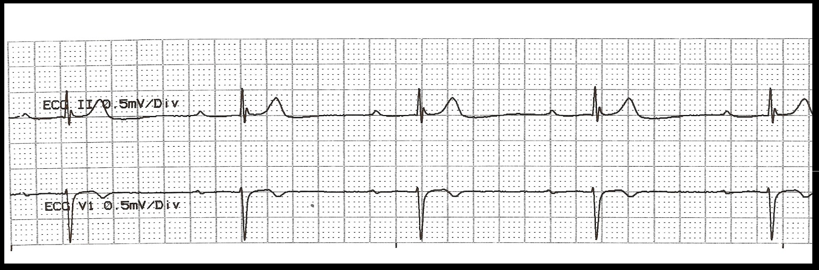 Basic EKG Test 55