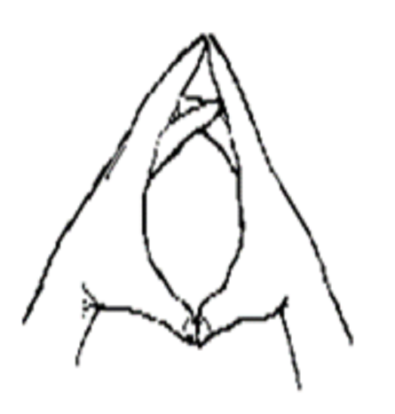 Runa- murmurul Creației: 4 Runa OS - OTHIL,