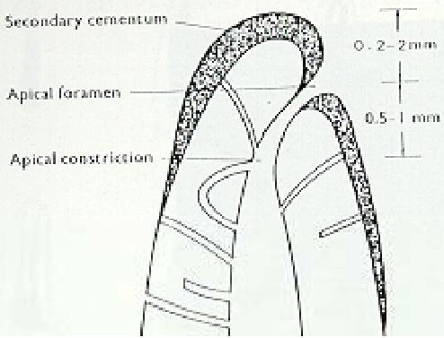 Dentistry lectures for MFDS/MJDF/NBDE/ORE: Principles of Access Cavity ...