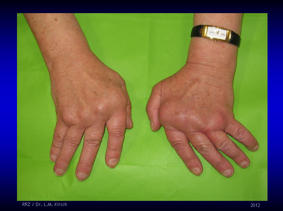 Rheumatologe: Verschiedene Schmerzarten in der Rheumatologie