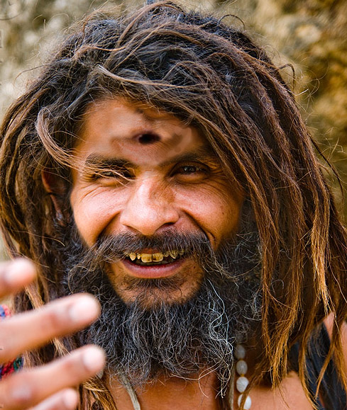 Really News Stories ? : Man Awakens With Third Eye.