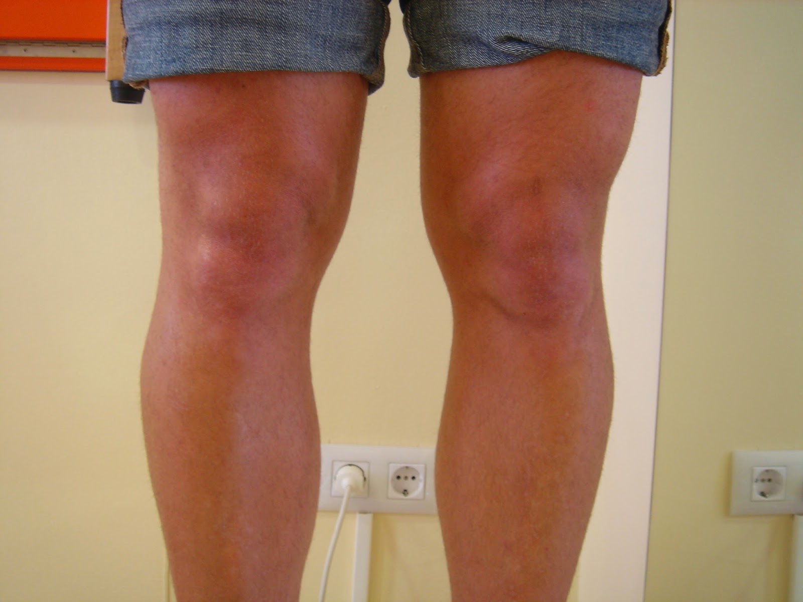 Clínica Podològica Raúl Llorca - Noticias Clinica: Dolor en la rodilla ...