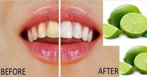 Lemon is good medicine to save the teeth | NEPALI ONLINE