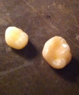 The Wog Blog: Last Baby Tooth