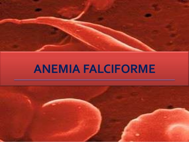 Anemia Falciforme: Você sabe o que é?